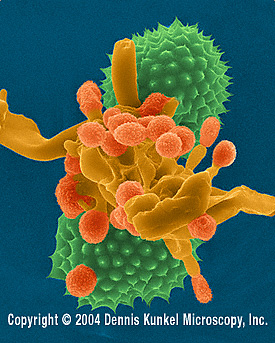 BIOL 3702: Microbiology Laboratory - Fall 2007